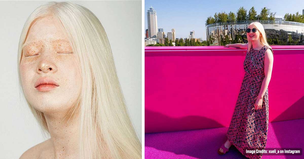 Chinese Girl who was Left Alone by her Birth Parents when she was only ...