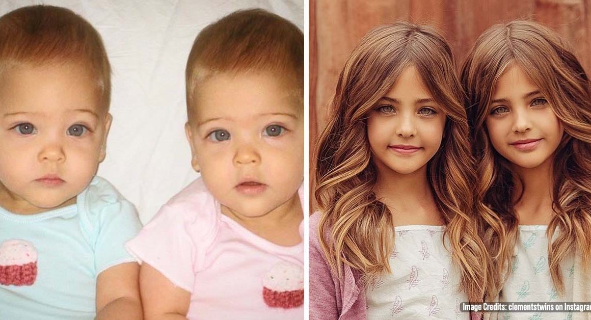 Years Ago They Were Called ‘The World’s Most Beautiful Twins’ - Now ...